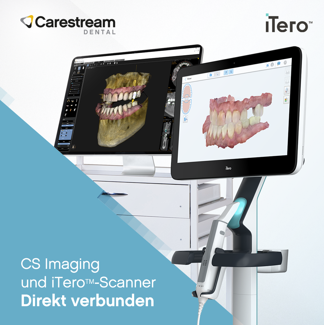 Carestream CS Imaging & iTero IO Scanner von Align Technology - blaudental