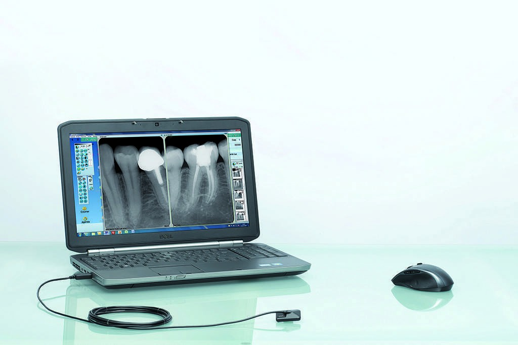 OWANDY OPTEO hochauflösender intraoraler Sensor NEU - blaudental