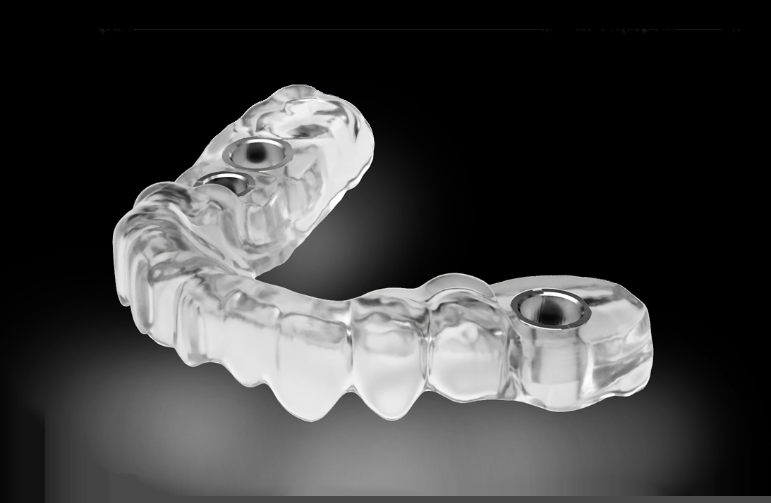 SICAT SURGICAL GUIDES - blaudental